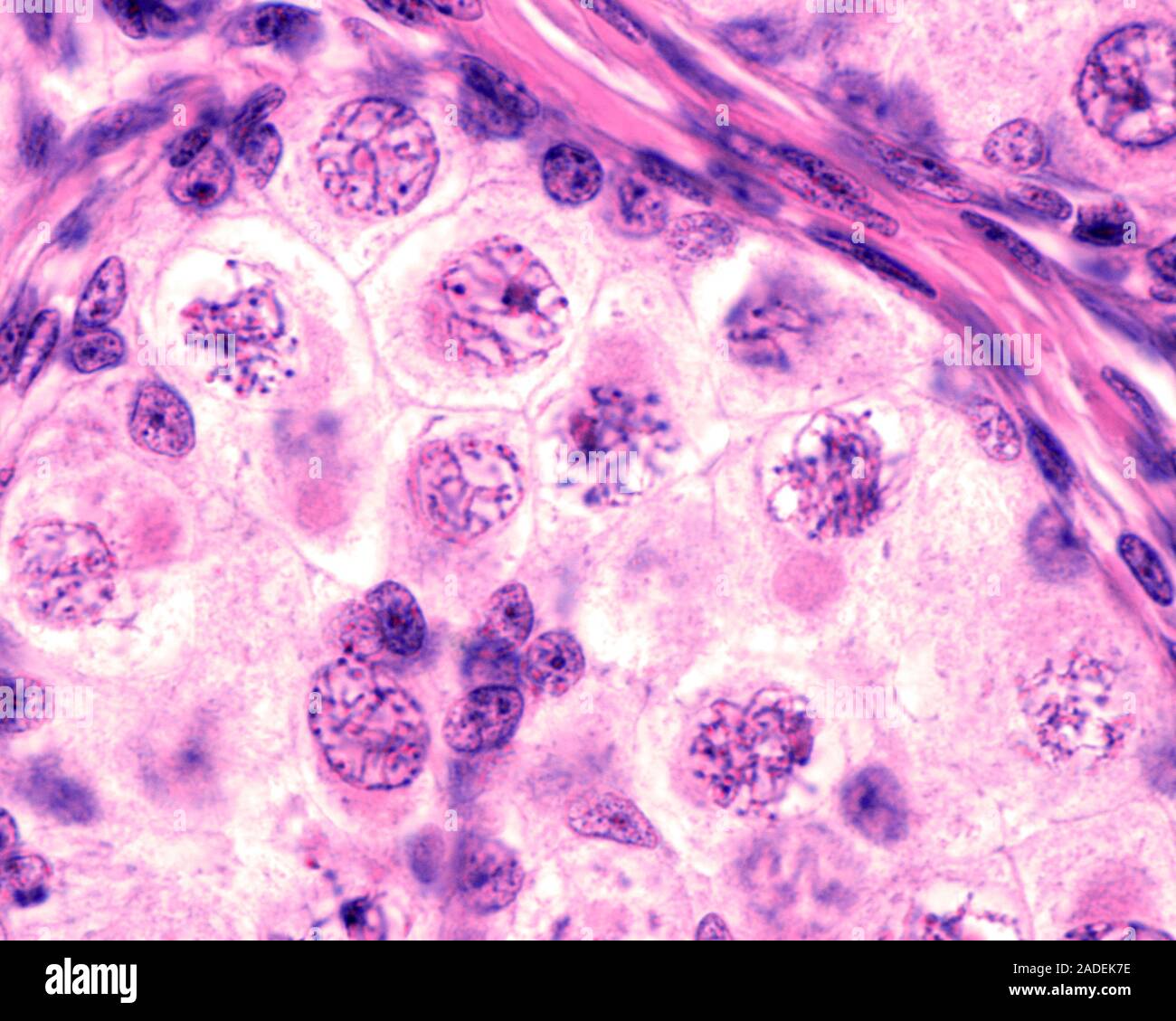Light micrograph of a fetal ovary showing several oocytes (immature egg ...
