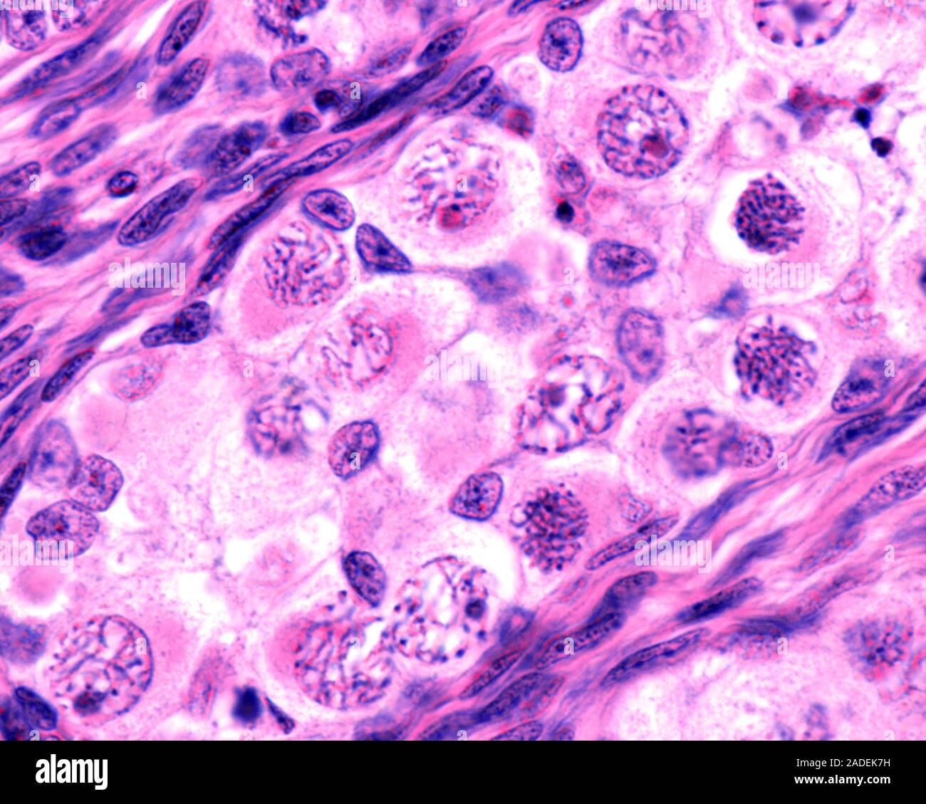 Light micrograph of a fetal ovary showing several oocytes (immature egg ...