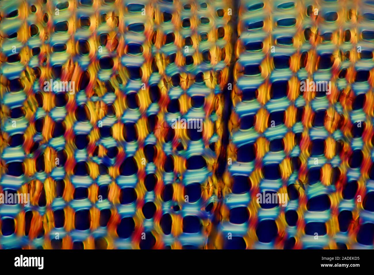 Xylem tissue from yew tree, polarized light micrograph. This ...