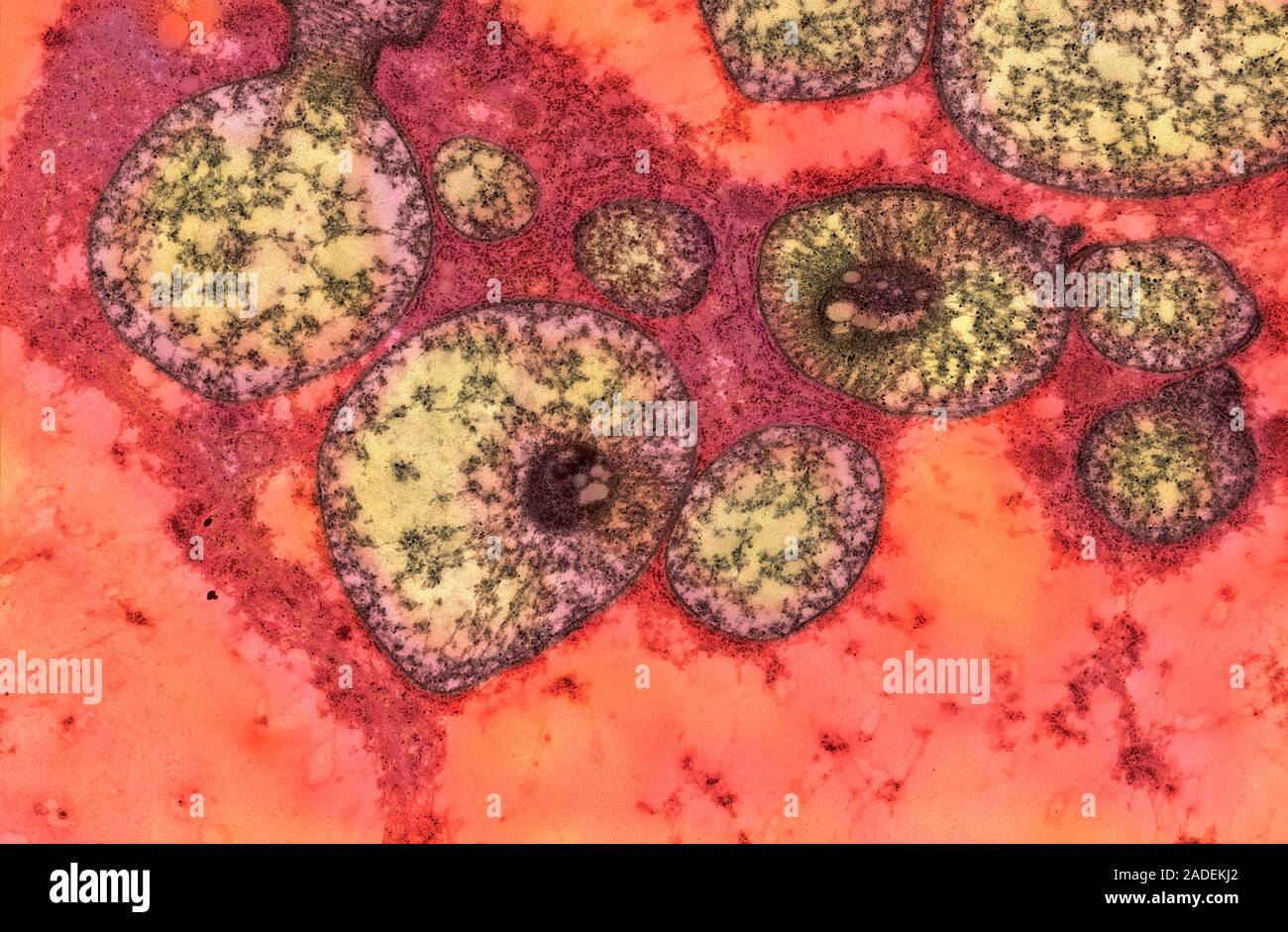 Abnormal mitochondria in acidemia. Coloured transmission electron ...