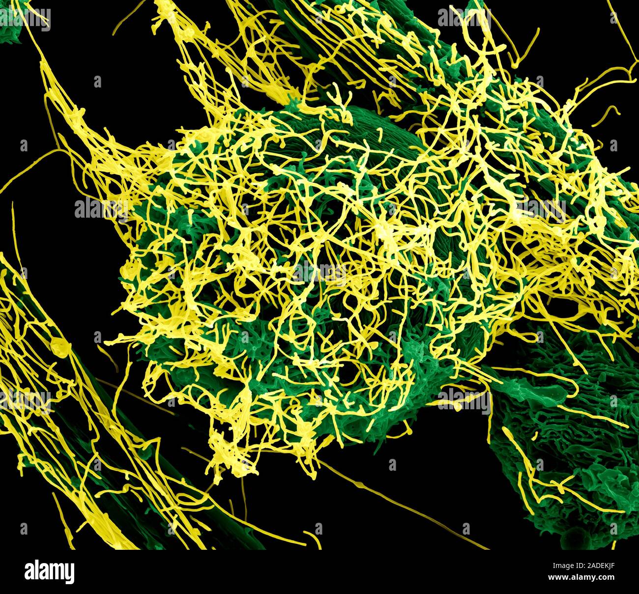 Ebola virus particles. Coloured scanning electron micrograph (SEM) of ...