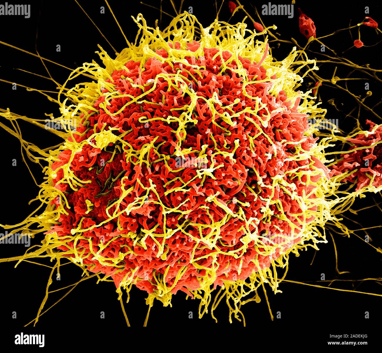 Ebola virus particles. Coloured scanning electron micrograph (SEM) of ...