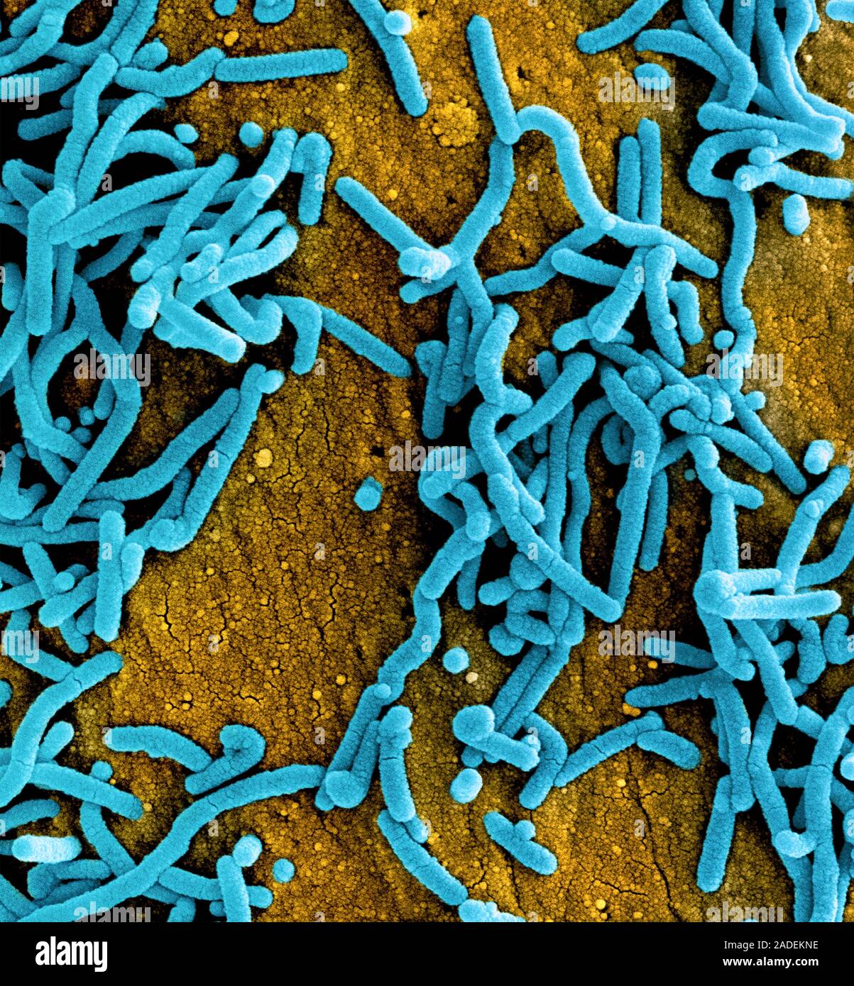 Marburg virus. Coloured scanning electron micrograph (SEM) of marburg ...