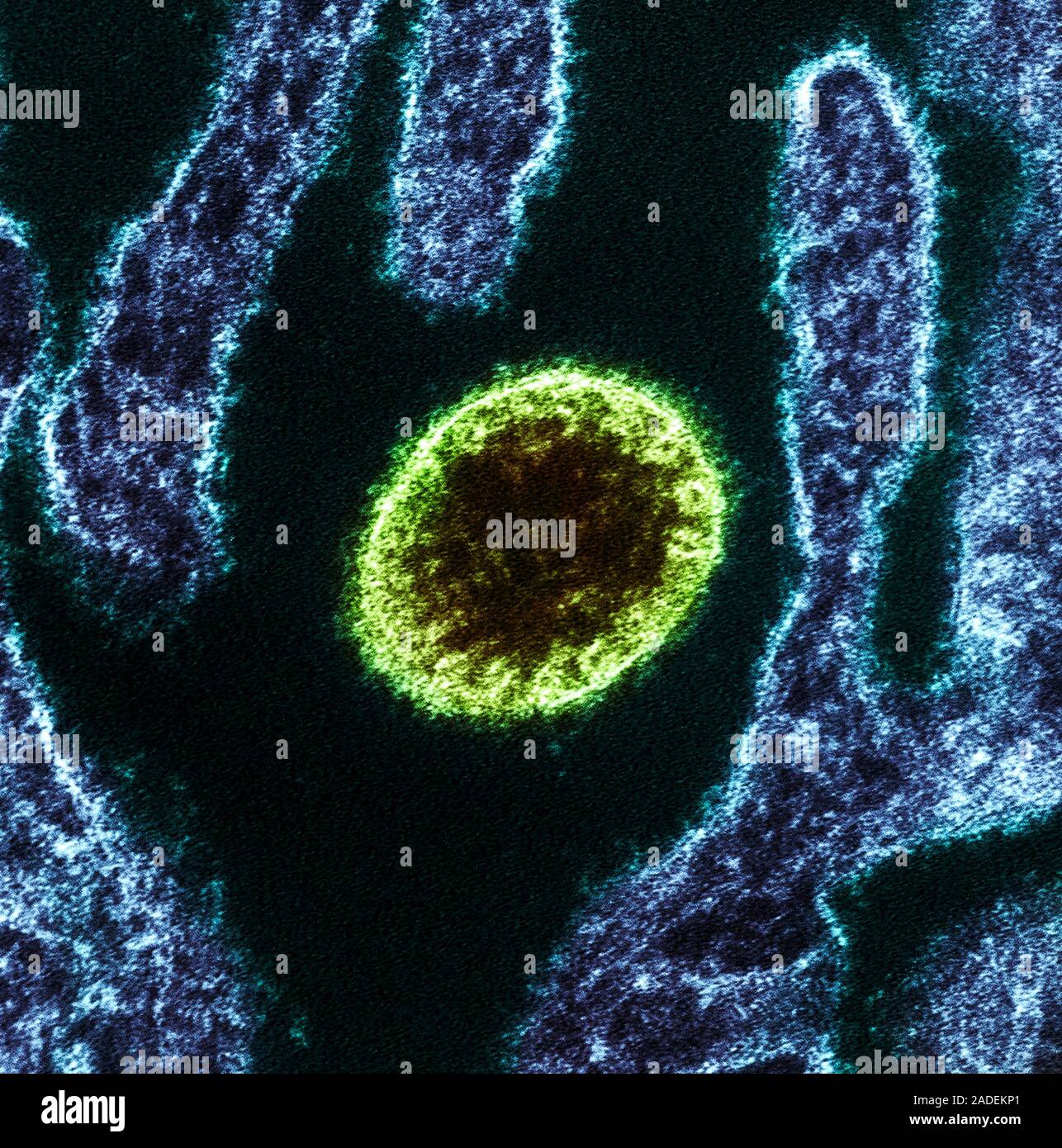 Nipah virus. Coloured transmission electron micrograph (TEM) of a ...