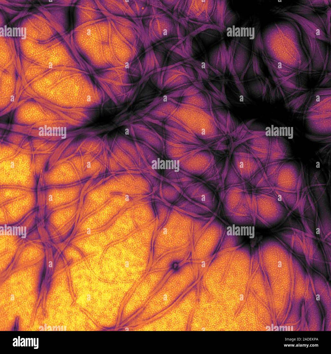 Prion proteins. Light micrograph of a section through prion protein ...