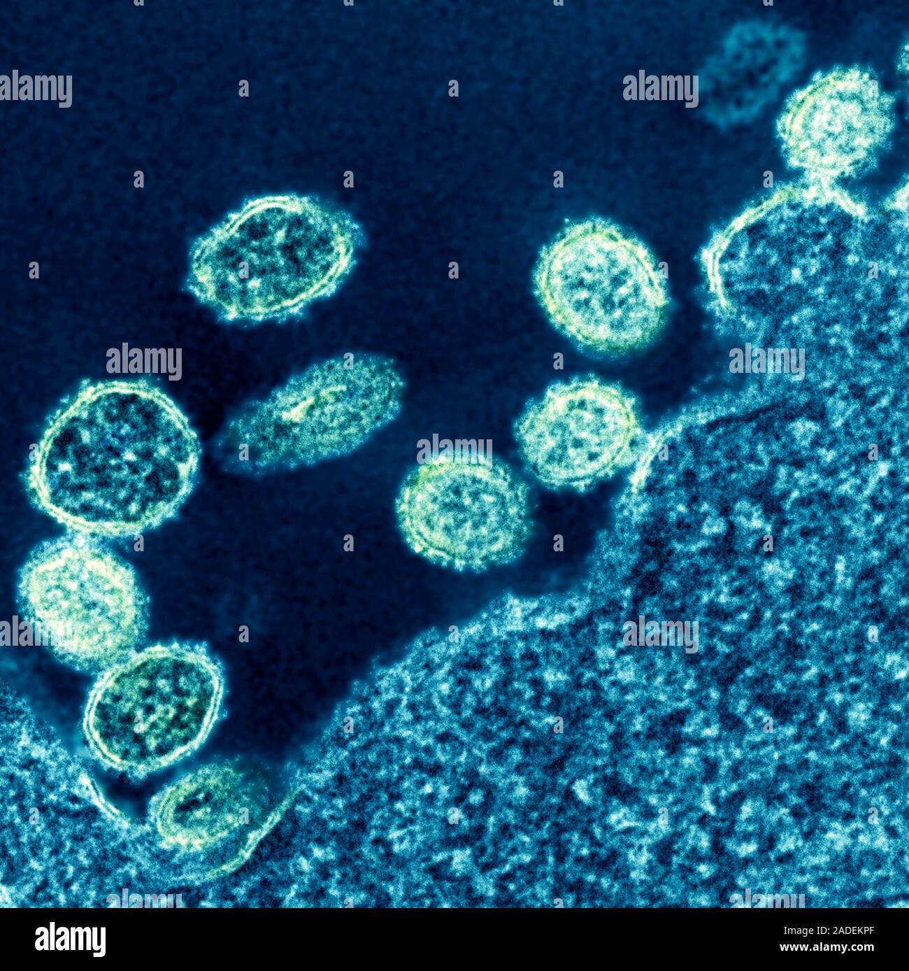 Spanish flu virus. Transmission electron micrograph (TEM) of 1918 H1N1 ...