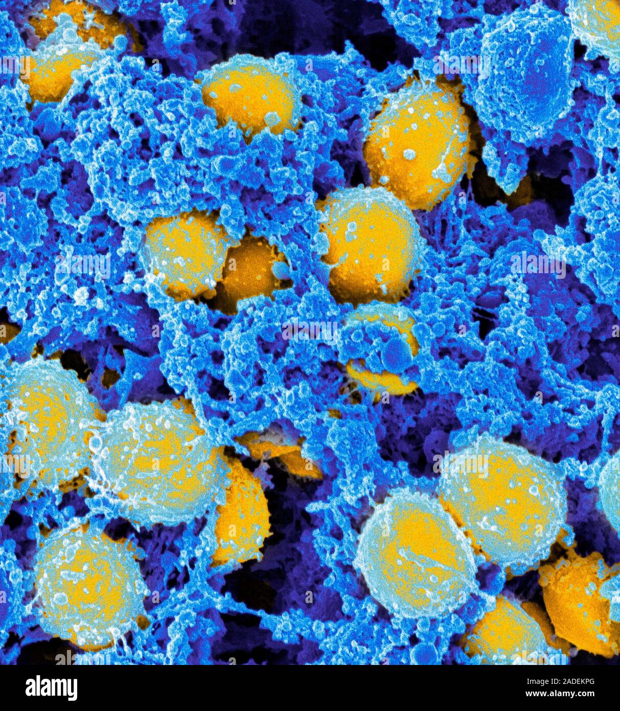 Staphylococcus aureus bacteria. Coloured scanning electron micrograph ... Staphylococcus aureus bacteria. Coloured scanning electron micrograph ...