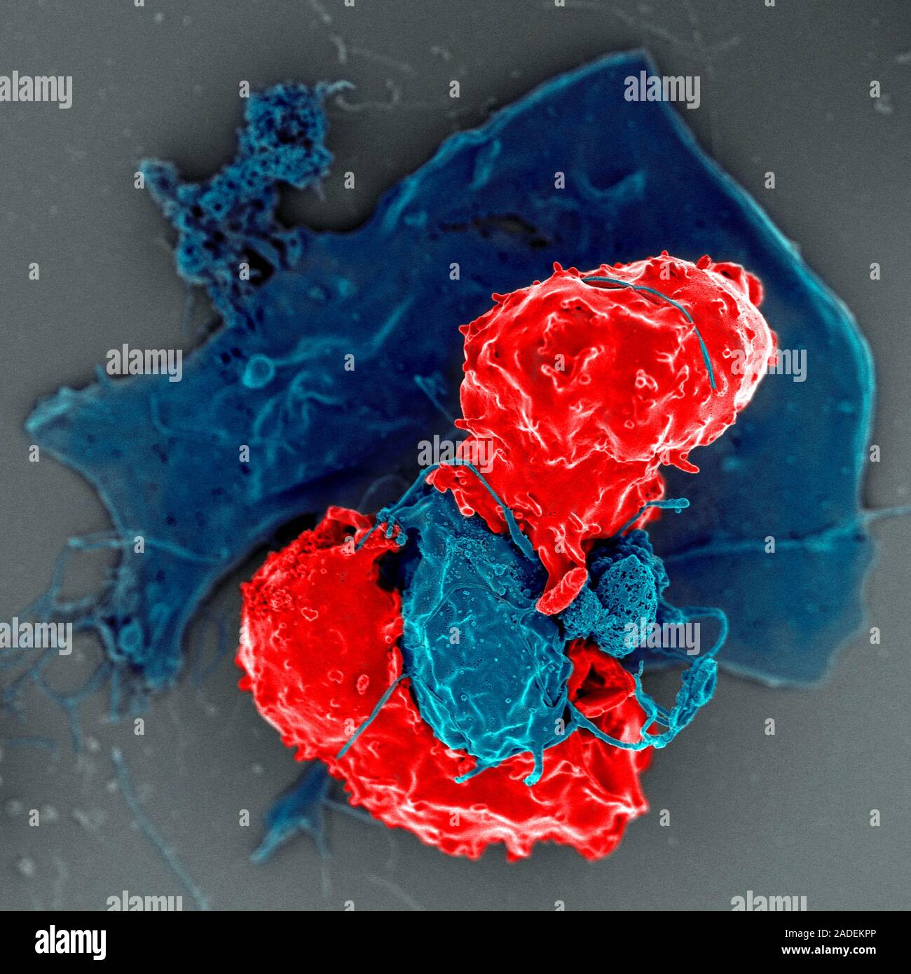 Regulatory T cells. Scanning electron micrograph (SEM) of regulatory T ...