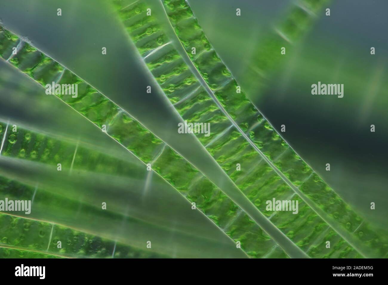 Algal strands, light micrograph. Algae consist of a range of diverse ...