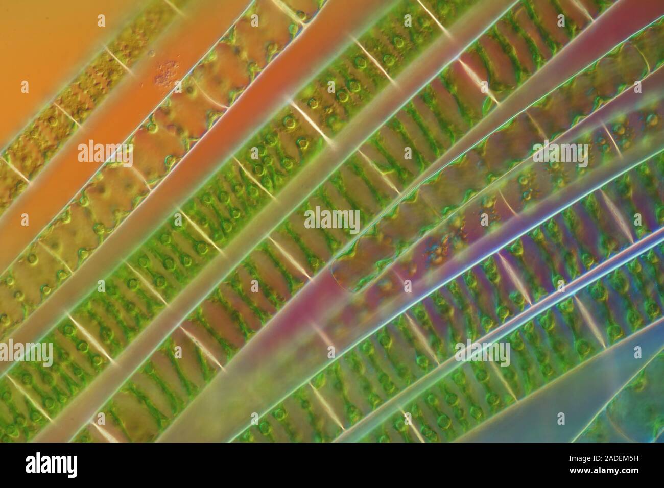 Algal strands, light micrograph. Algae consist of a range of diverse ...