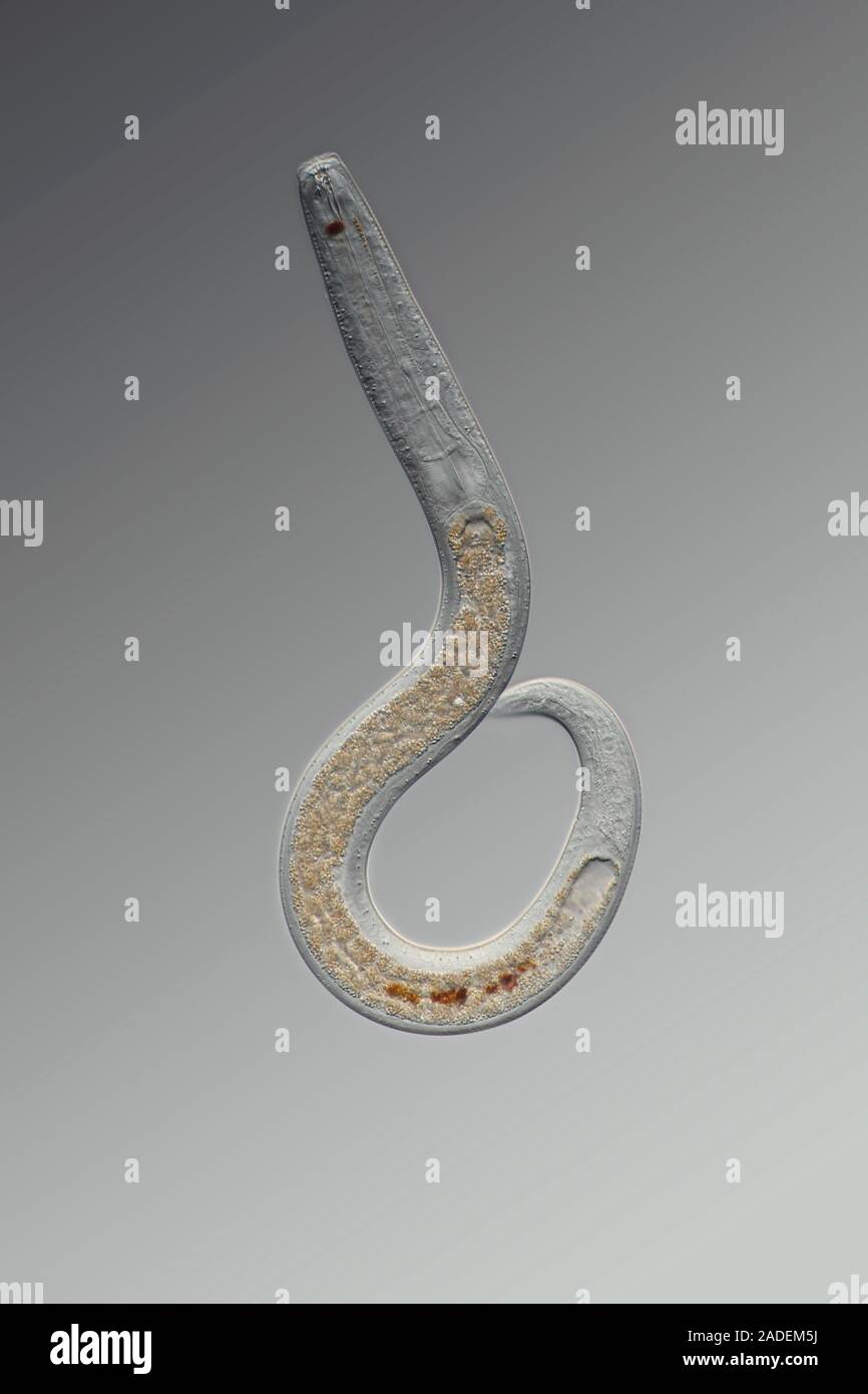 Nematode worm, light micrograph. Nematode worms are small worms that ...