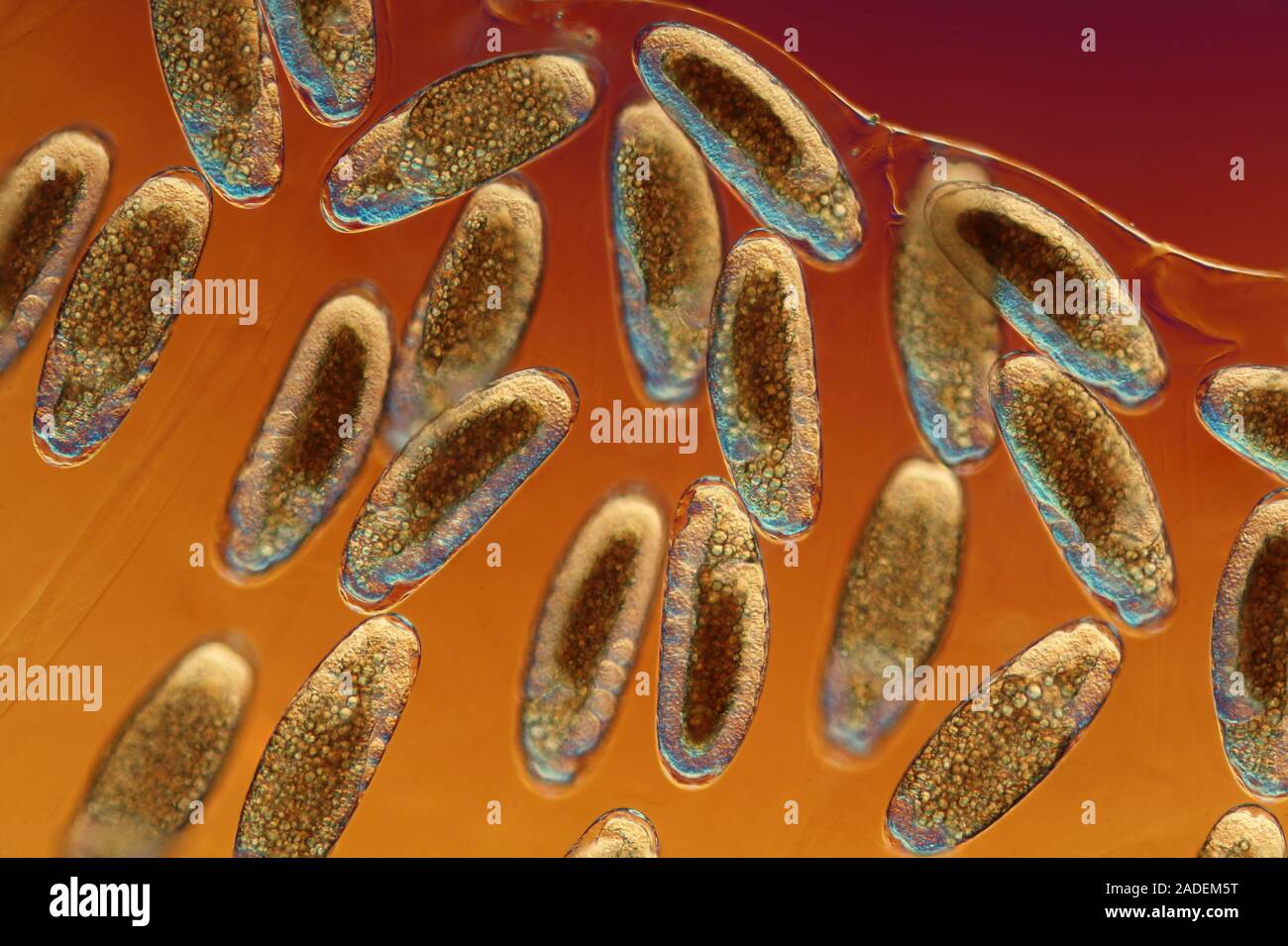 Fly eggs, light micrograph. These eggs have been laid by a Diptera fly ...