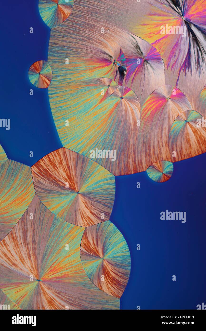 Dopamine crystals, differential interference contrast light micrograph ...