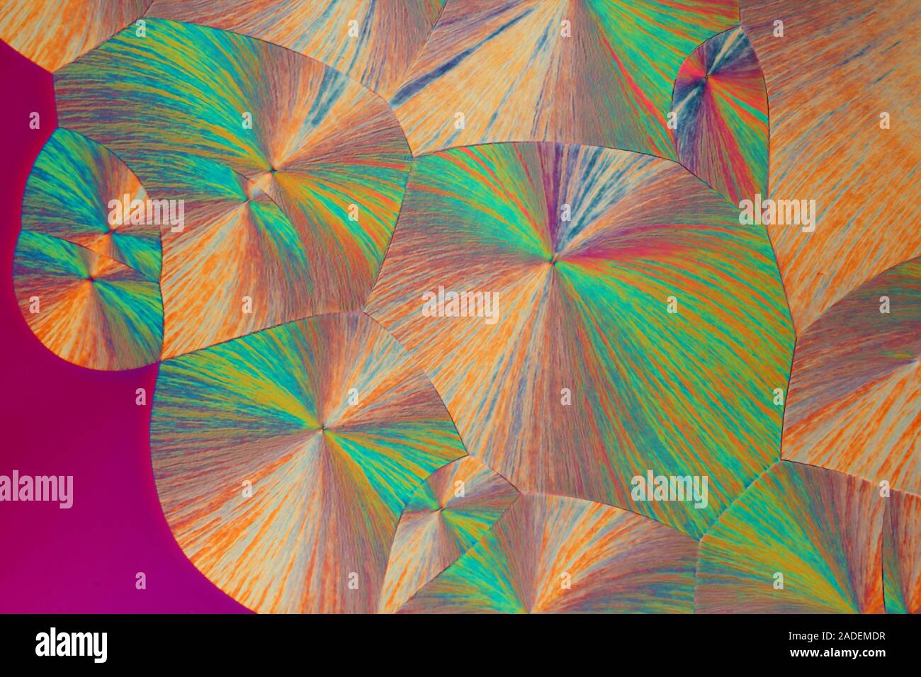Dopamine crystals, differential interference contrast light micrograph ...