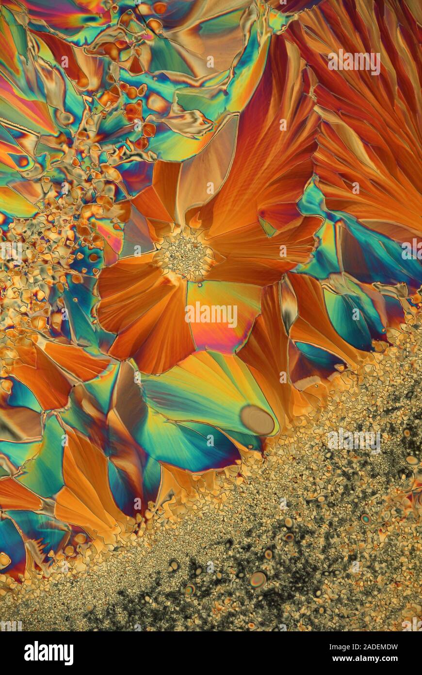 Dopamine crystals, differential interference contrast light micrograph ...