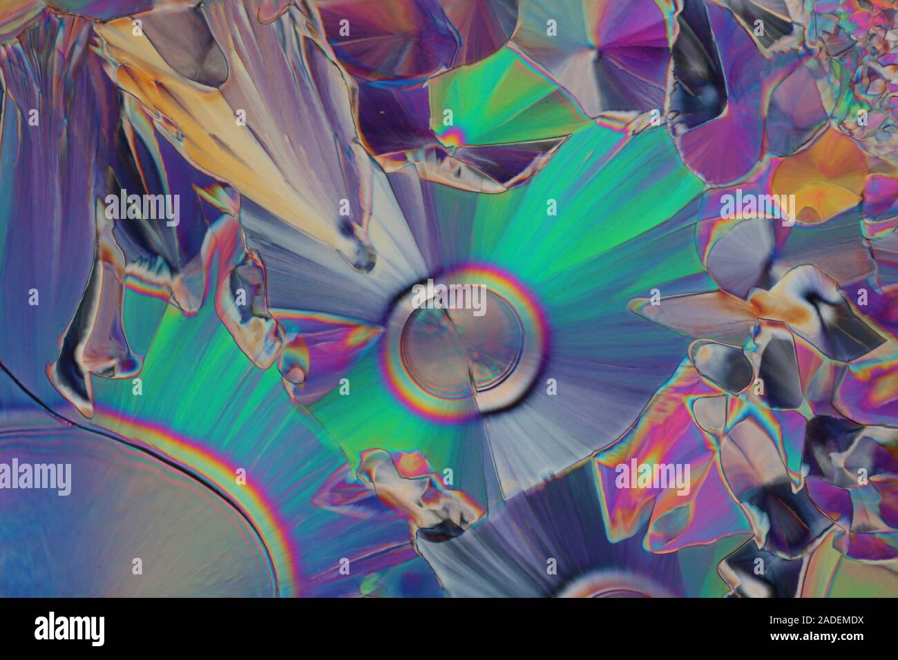 Dopamine crystals, differential interference contrast light micrograph ...