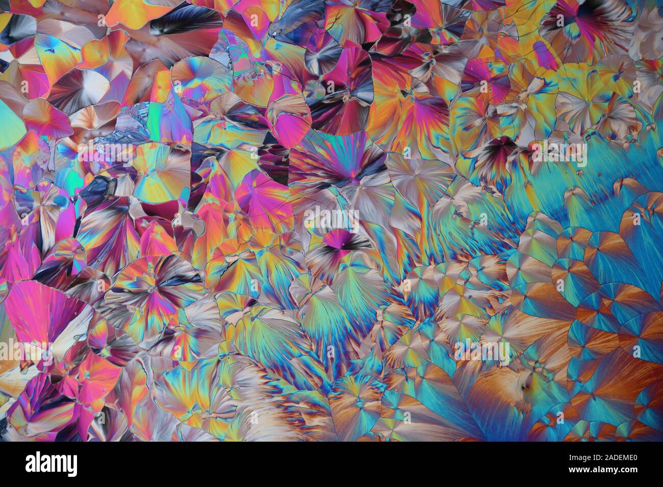 Dopamine crystals, differential interference contrast light micrograph ...