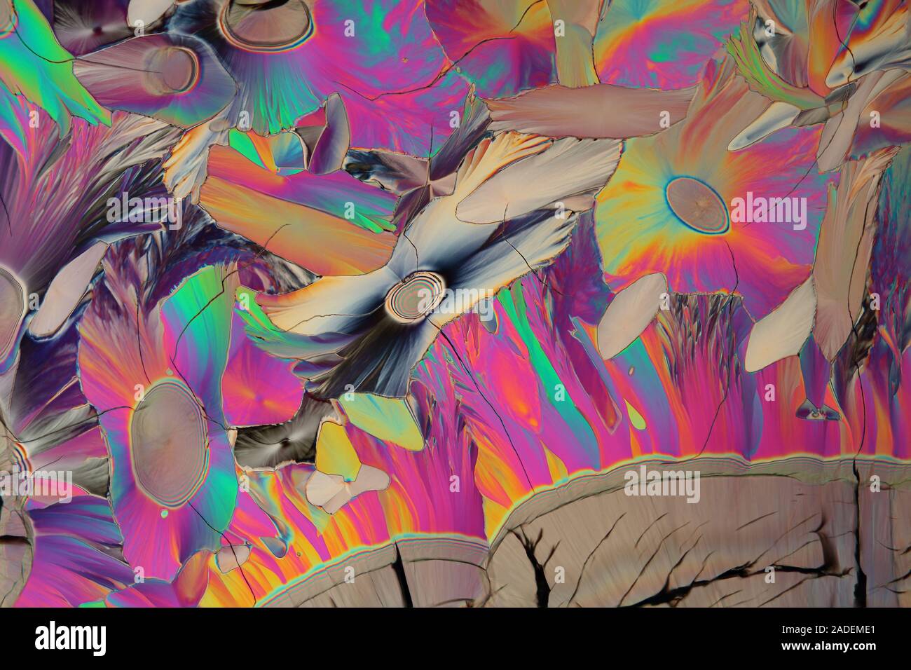 Dopamine crystals, differential interference contrast light micrograph ...