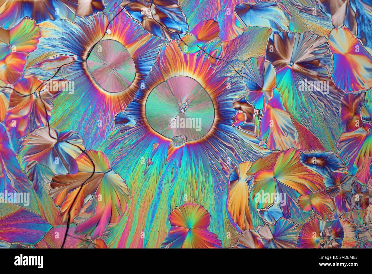 Dopamine crystals, differential interference contrast light micrograph ...