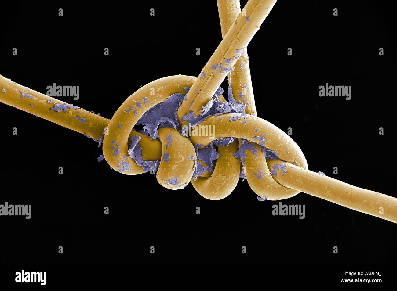 Images not to be used by the tobacco industry. Surgical thread from ...