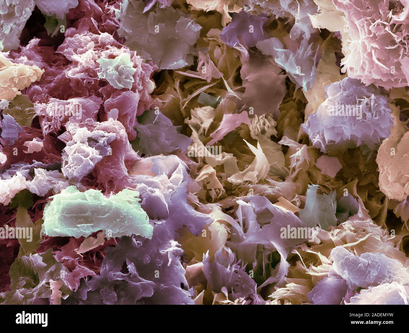 Fatberg. Coloured scanning electron micrograph (SEM) of the surface of ...
