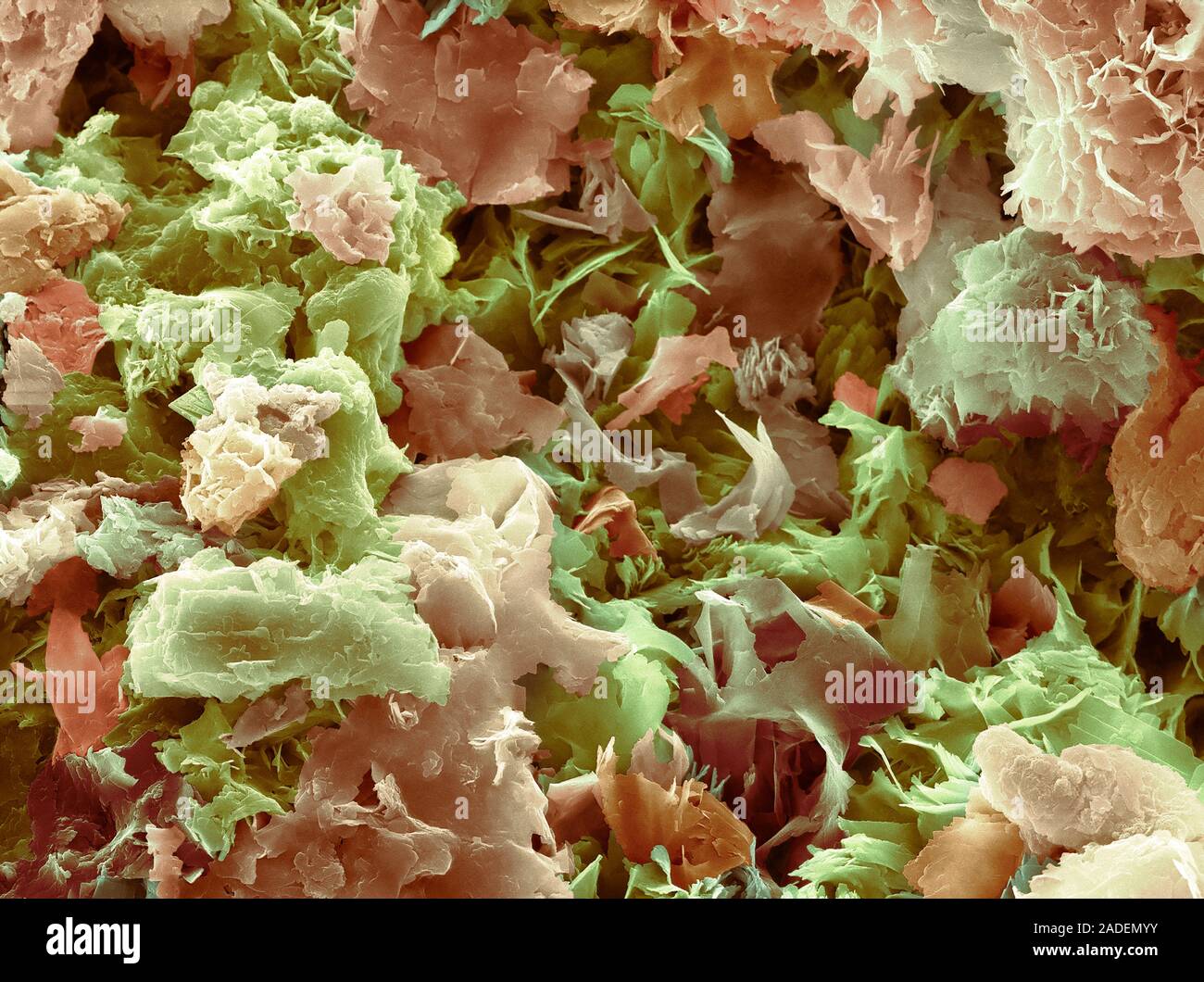 Fatberg. Coloured scanning electron micrograph (SEM) of the surface of ...
