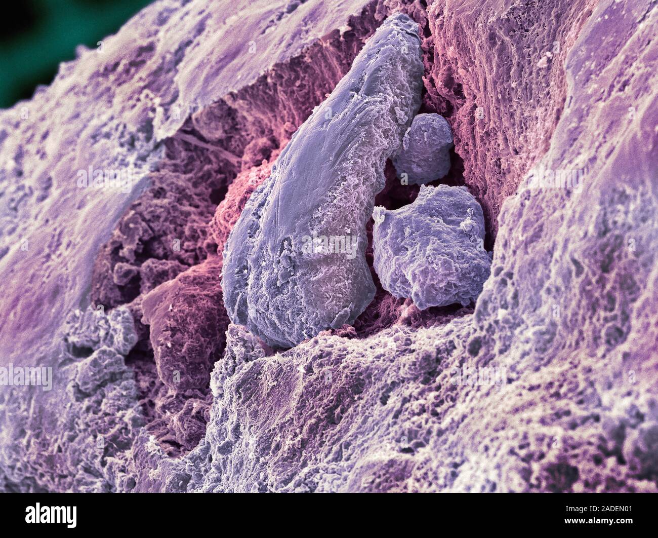 Fatberg. Coloured scanning electron micrograph (SEM) of the surface of ...
