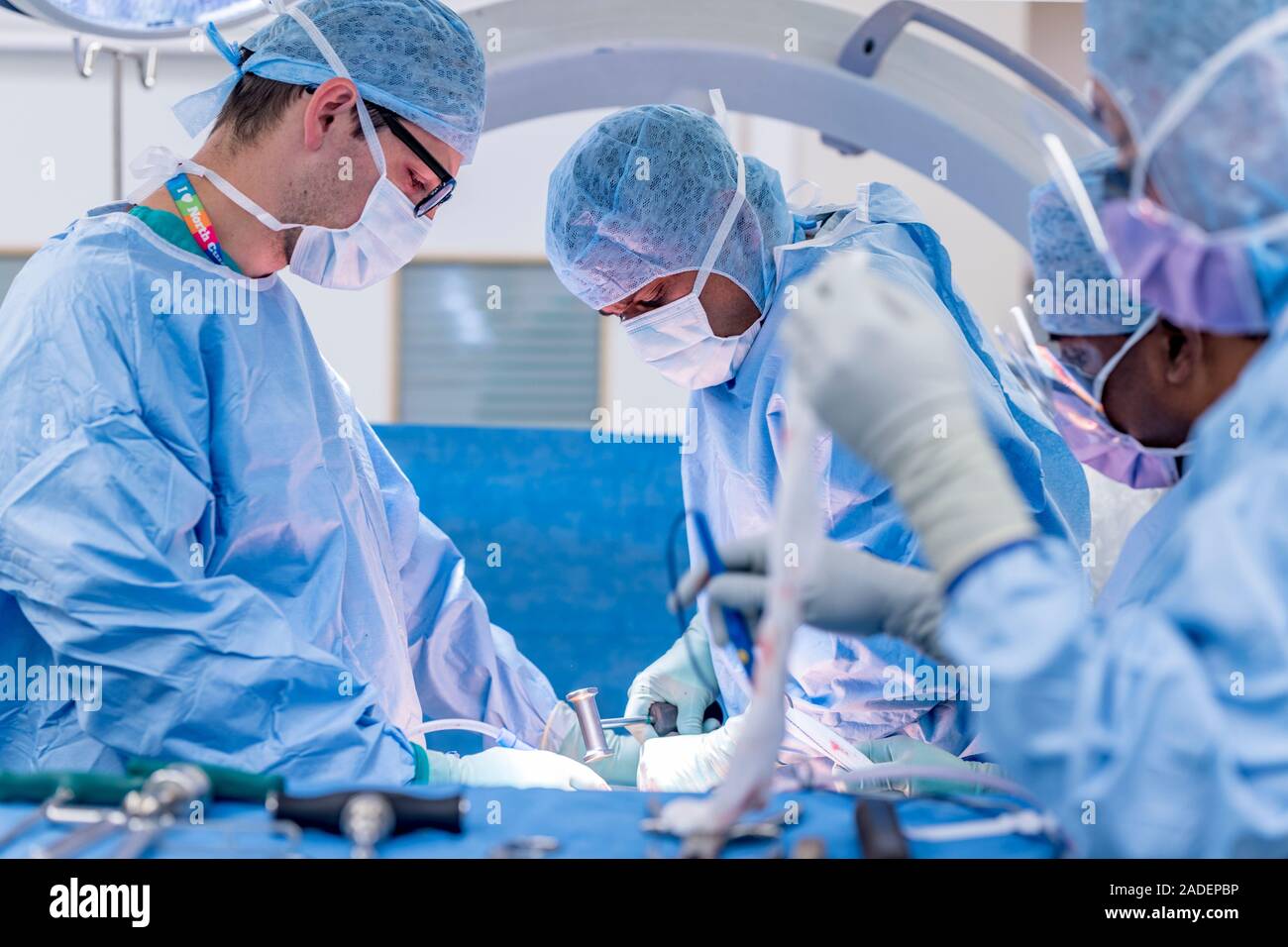 MODEL RELEASED. Spinal surgery. This operation is a revision of ...