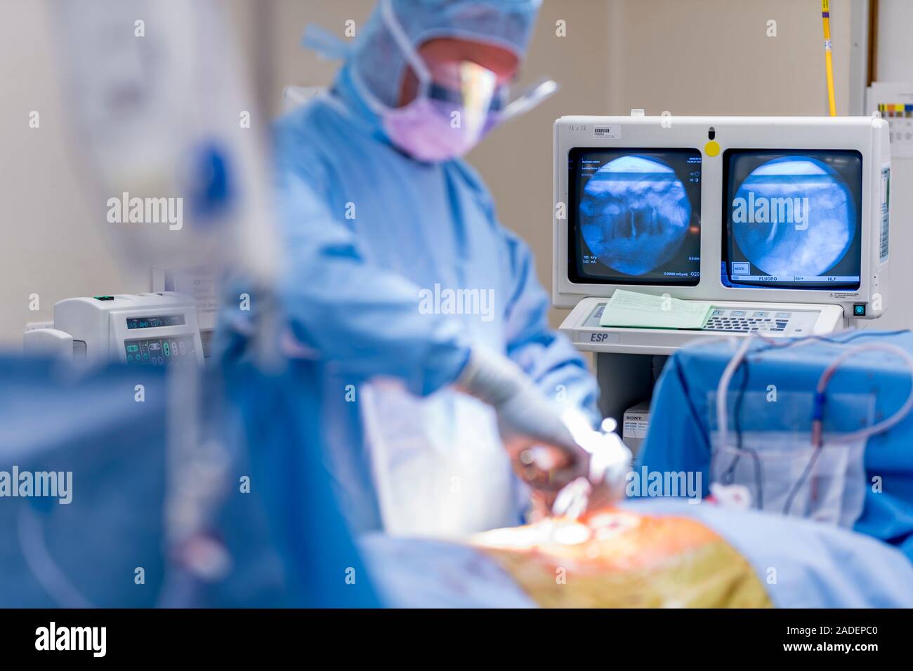 MODEL RELEASED. Spinal surgery and X-rays. Member of a surgical team ...