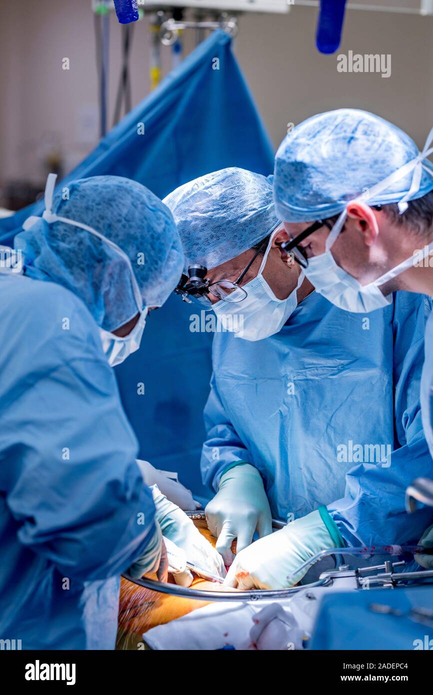 MODEL RELEASED. Spinal surgery. This operation is a revision of ...