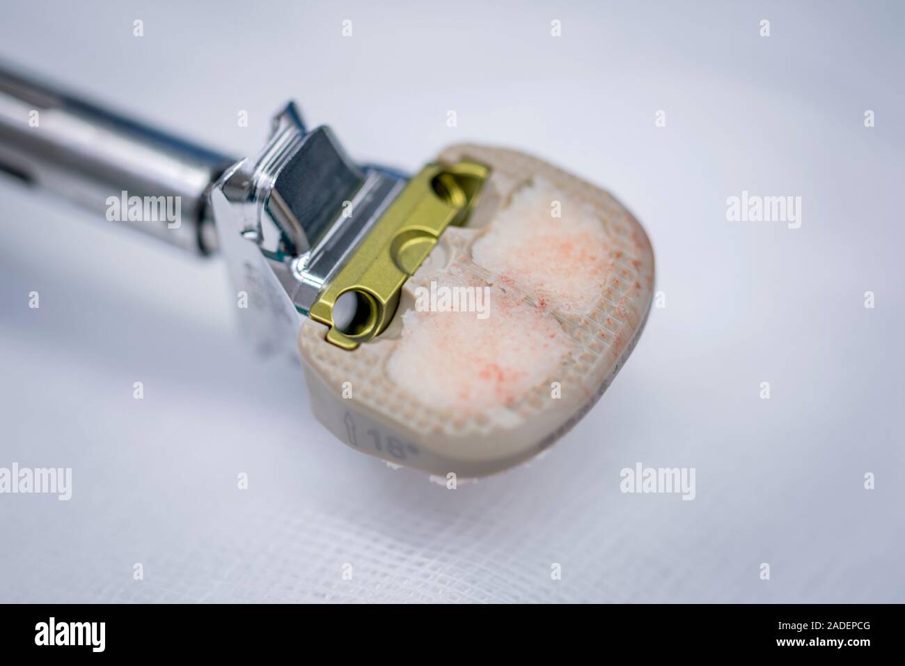 Spinal fusion implant and bone graft paste. This implant will be placed ...