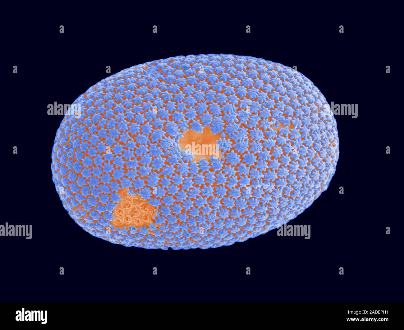 Images not to be used by the tobacco industry. Sponge spicule, coloured ...