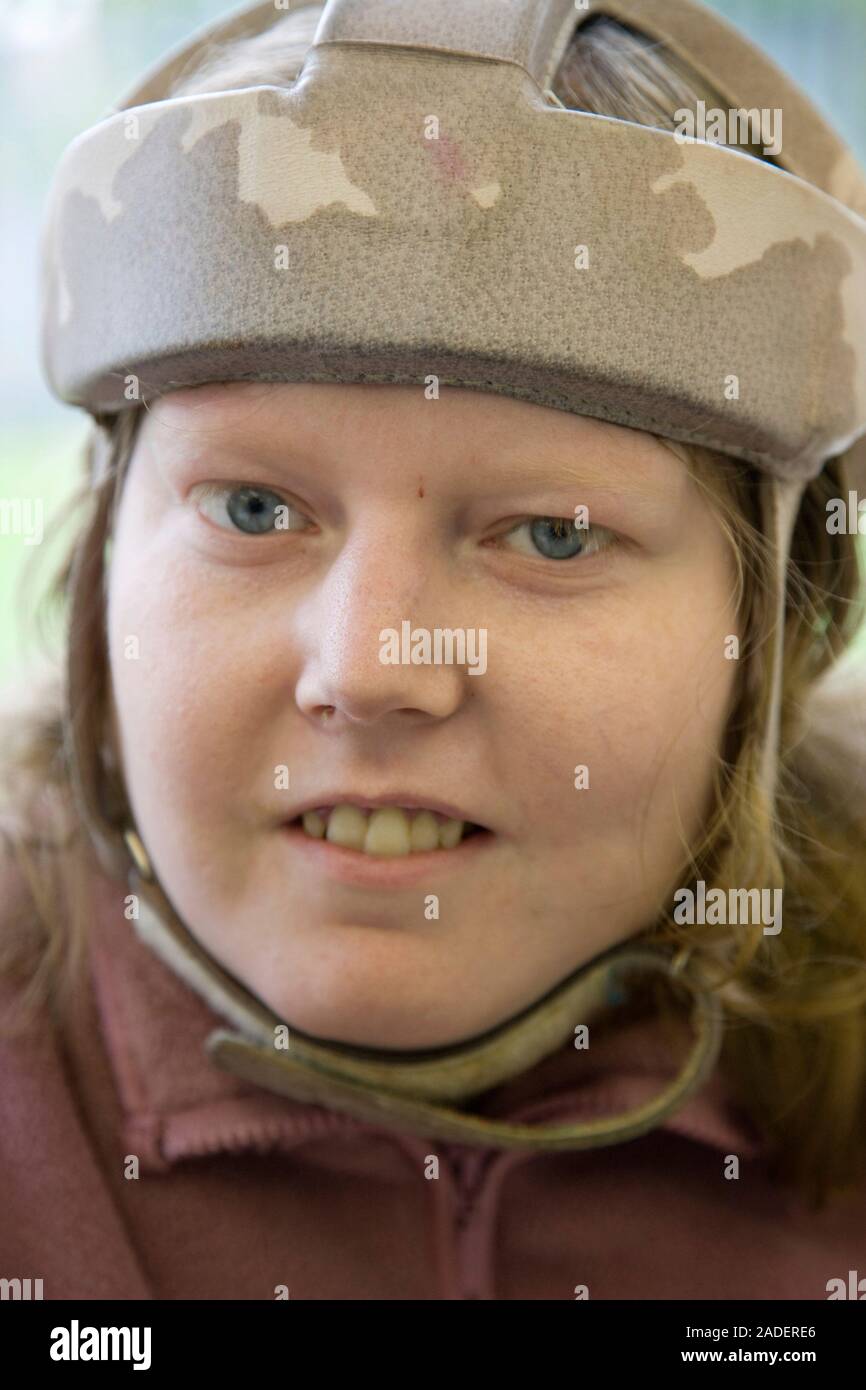 Mentally Handicapped Helmet