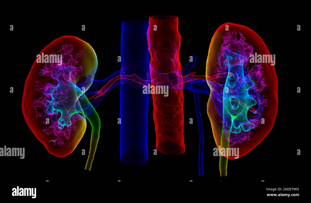 Kidneys and arteries and veins, 3D coloured magnetic resonance imaging ...