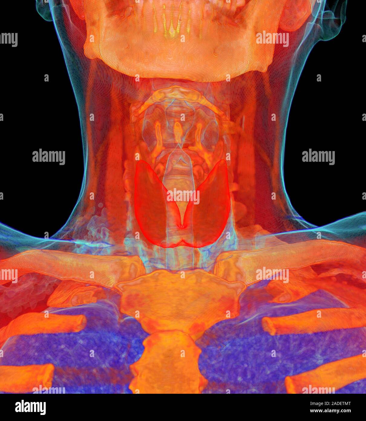 Human neck anatomy. 3D computed tomography (CT) scan of the anatomy of ...