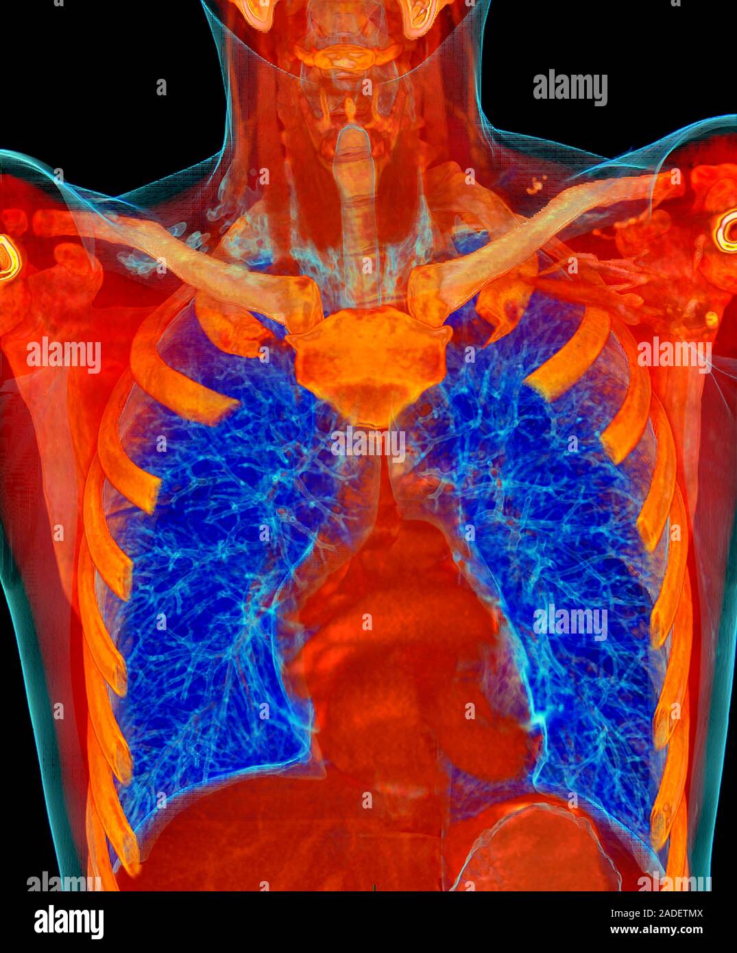 Human chest anatomy. 3D computed tomography (CT) scan of the anatomy of ...