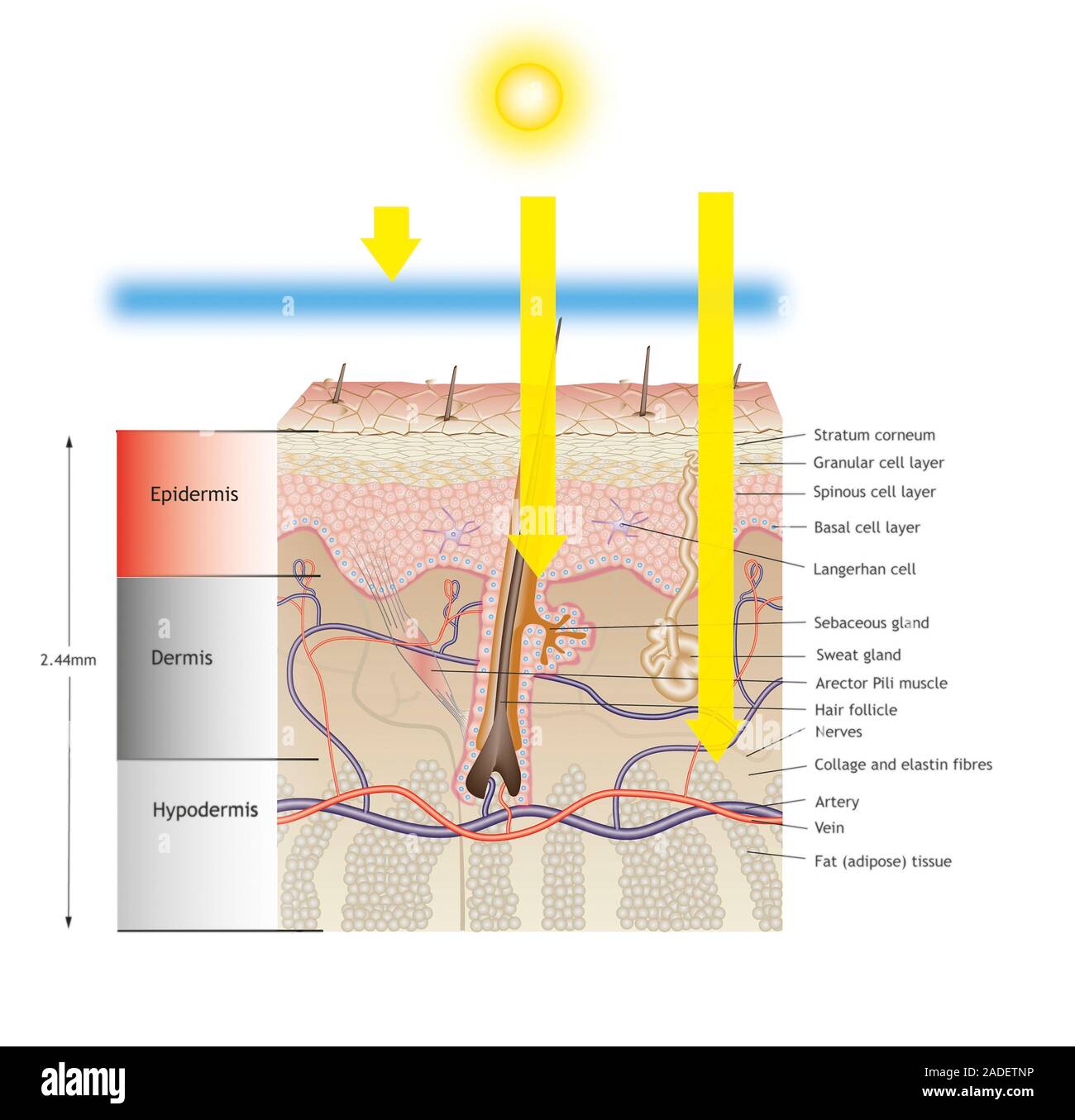 Sun damage to skin, illustration. There are three main types of ...