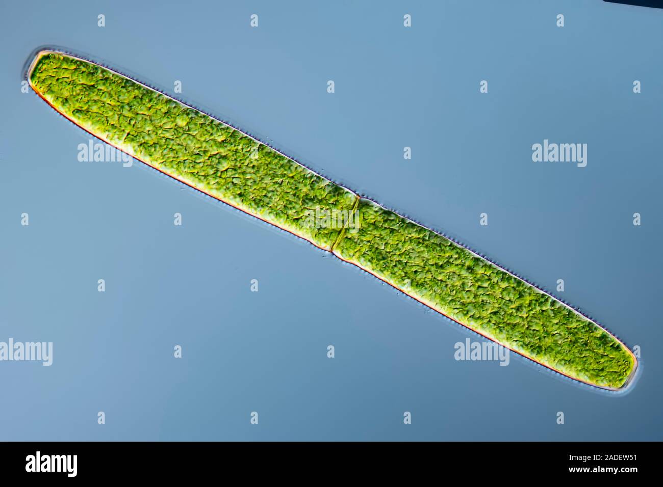 Pleurotaenium desmid. Differential interference contrast micrograph of ...
