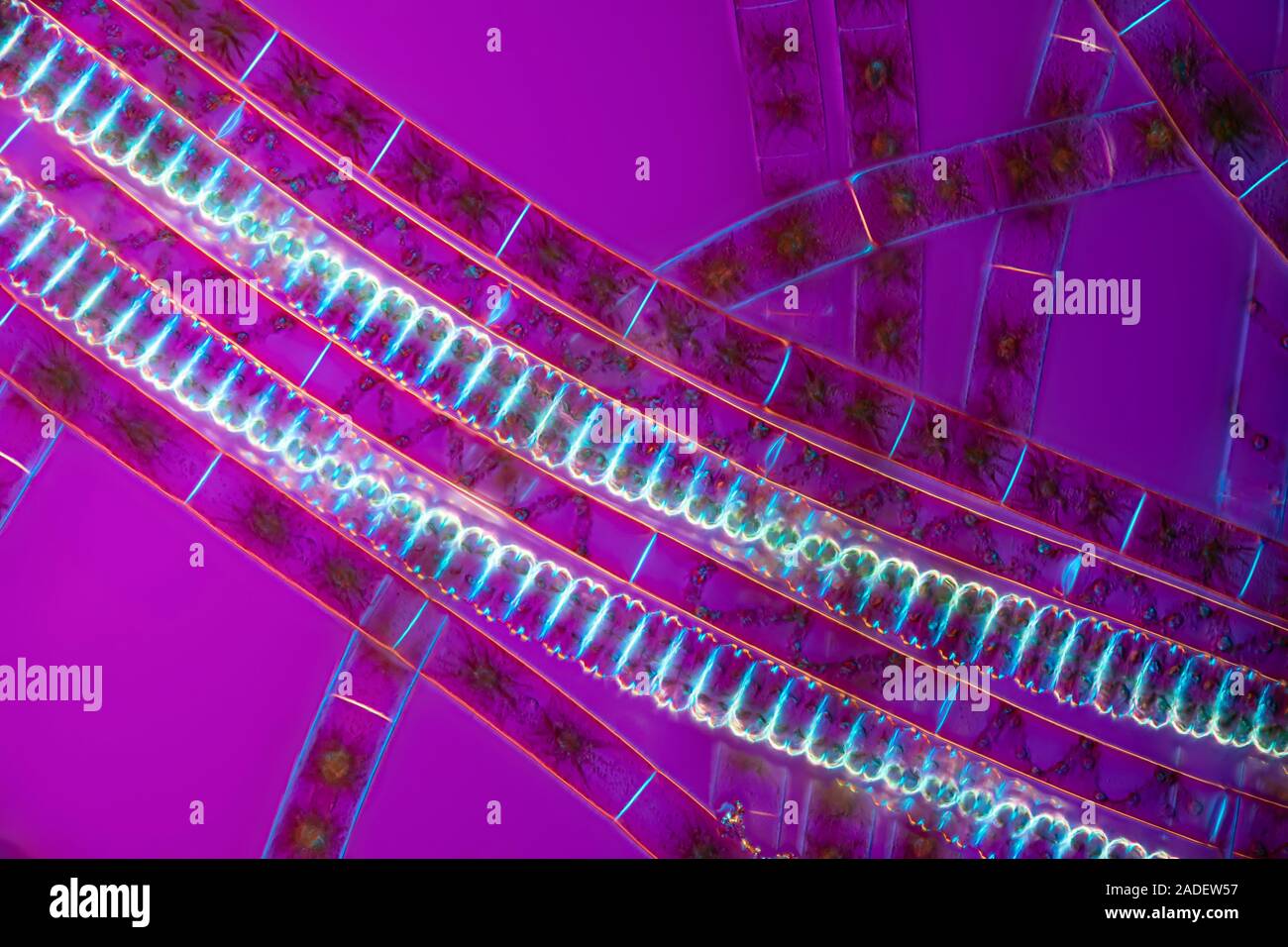 Desmid. Polarised light micrograph of the filamentous desmid Desmidium ...