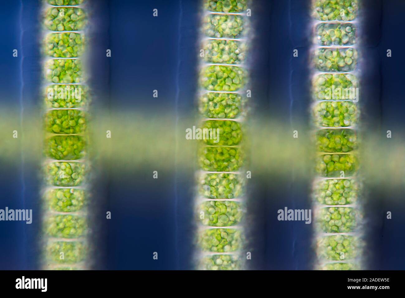 Hyalotheca desmids. Differential interference contrast micrograph of ...