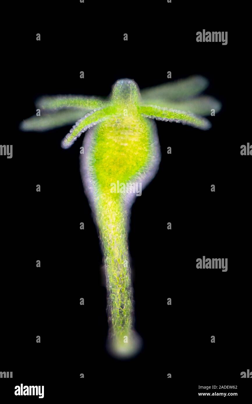 Green hydra. Darkfield illuminated light micrograph of the tentacled ...