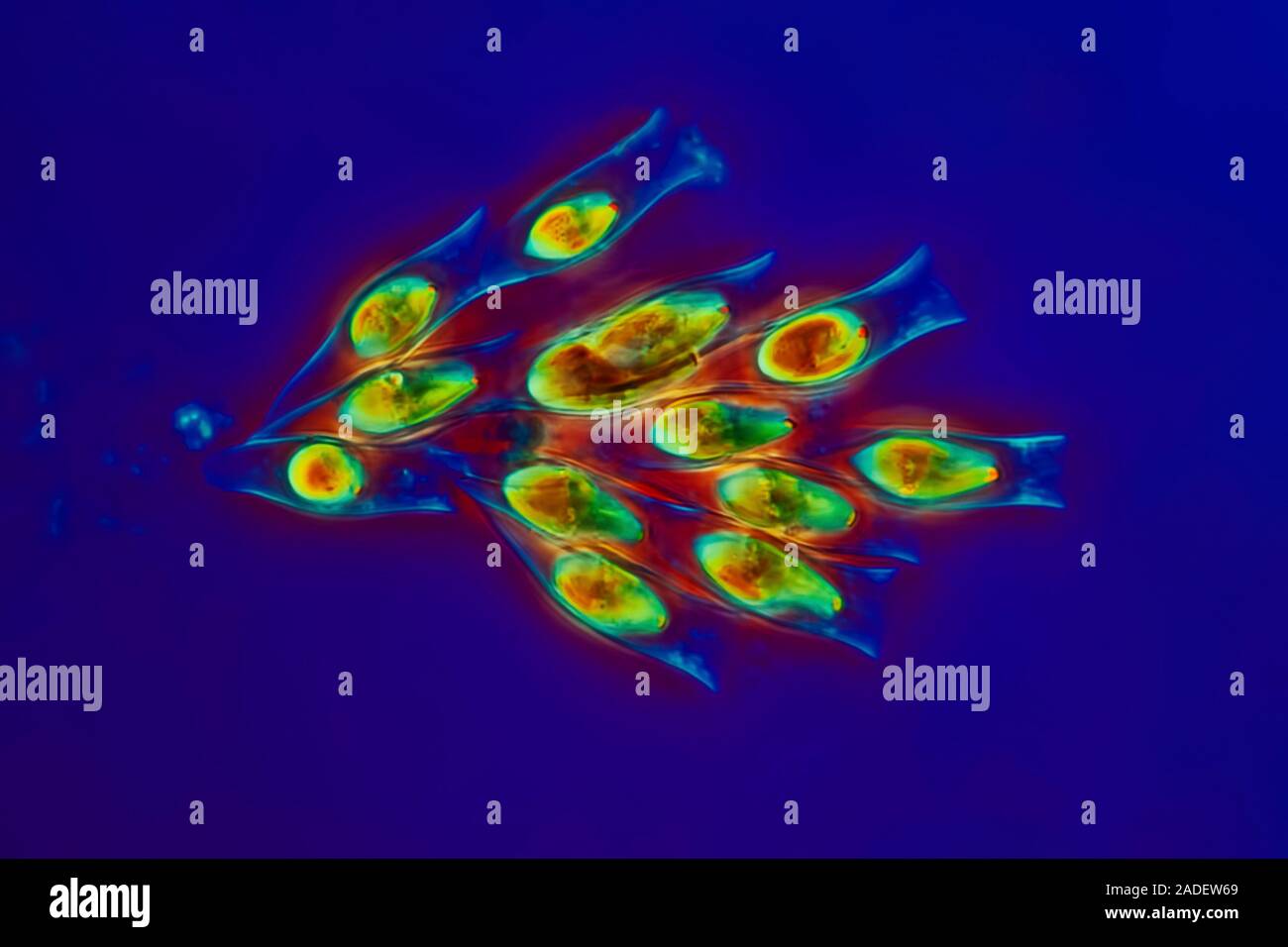 Light micrograph of a branching colony of the golden- brown alga ...