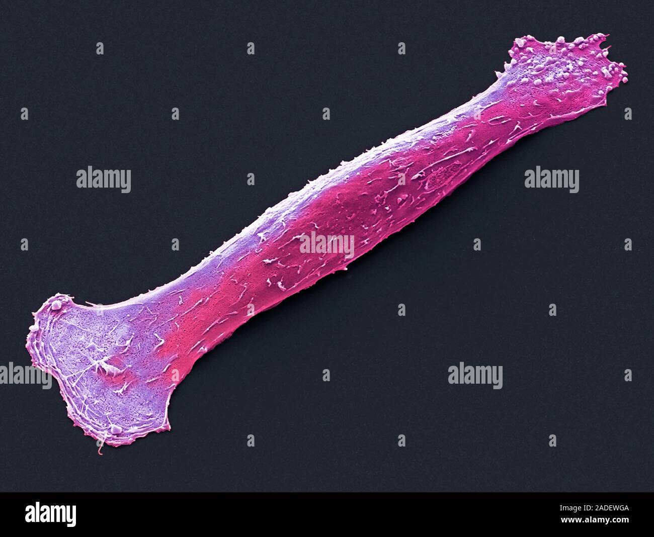 Muscle myoblast (primitive embryonic muscle cell) differentiating in to a skeletal muscle cell ...