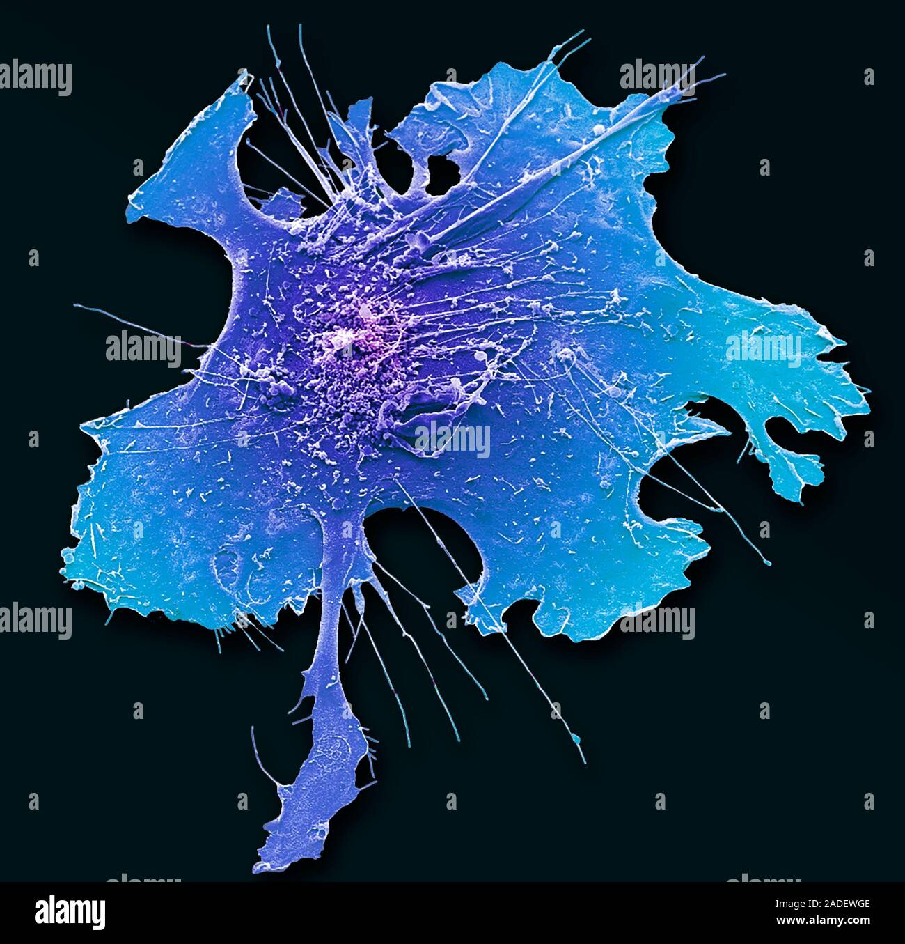 Osteoblast bone cell. Coloured scanning electron micrograph (SEM) of an ...