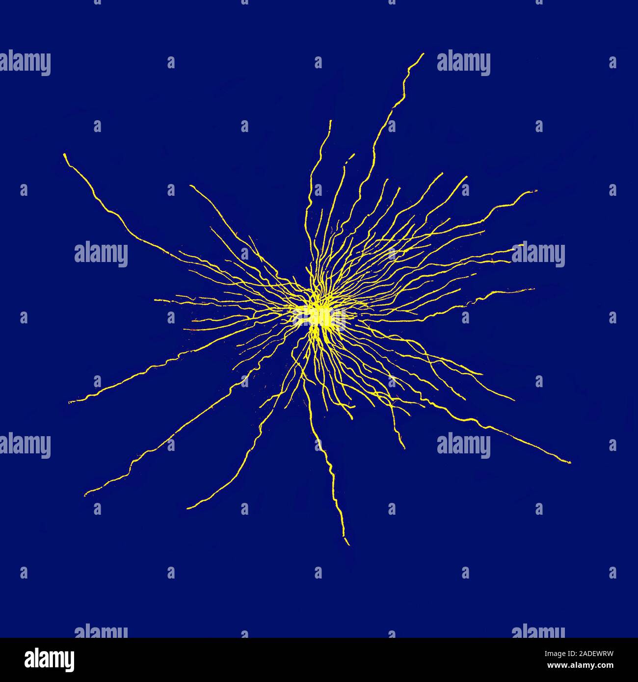 Illustration of an astrocyte cell from the spinal cord. Astrocytes are ...