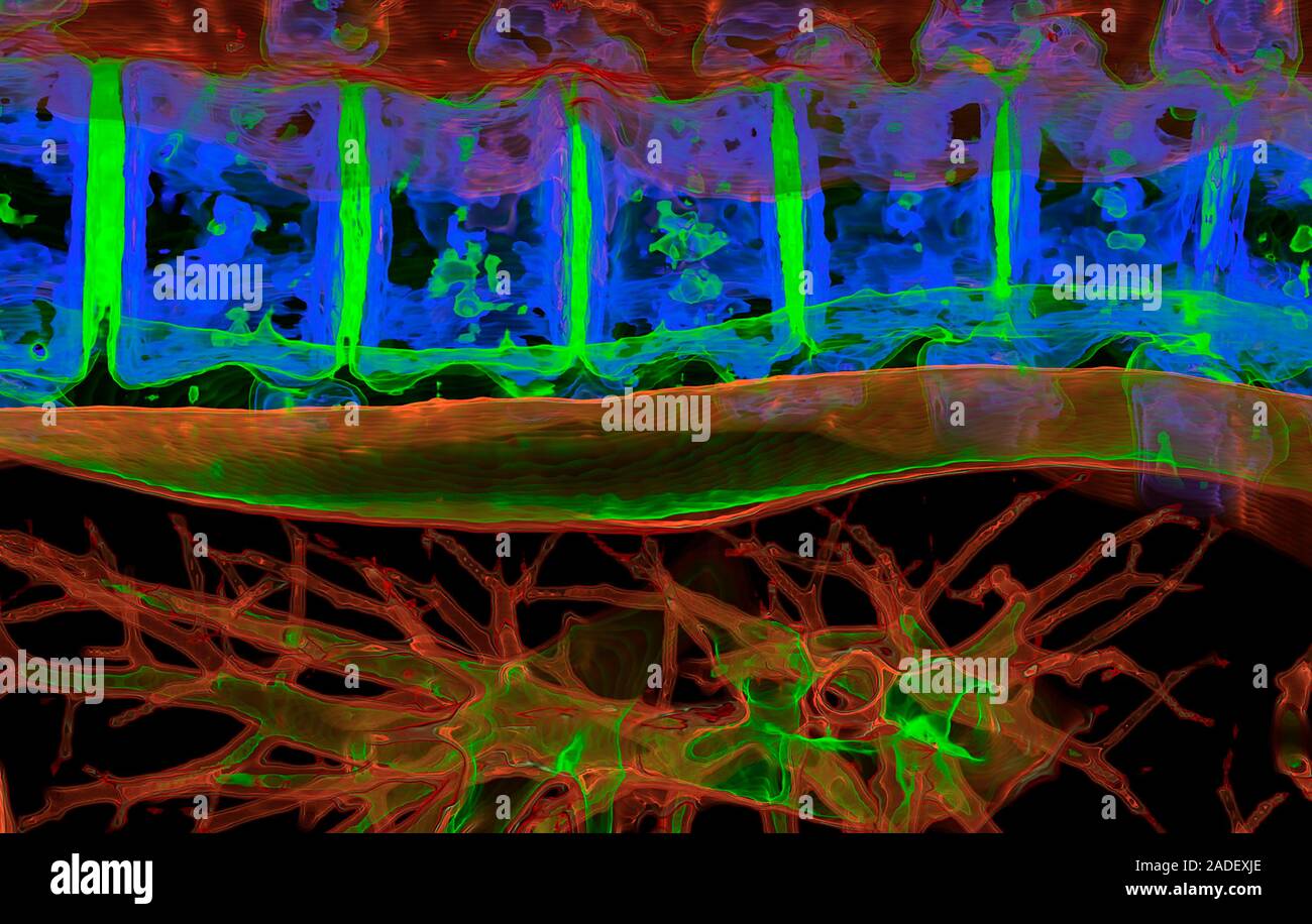 Lung airways and backbone, 3D coloured computed tomography (CT) scan ...