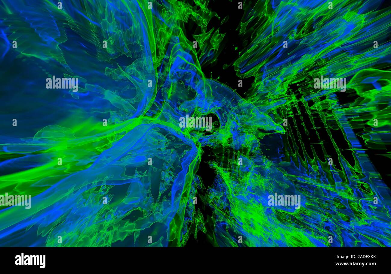 Brain tissue. Coloured sagittal magnetic resonance imaging (MRI) scan ...