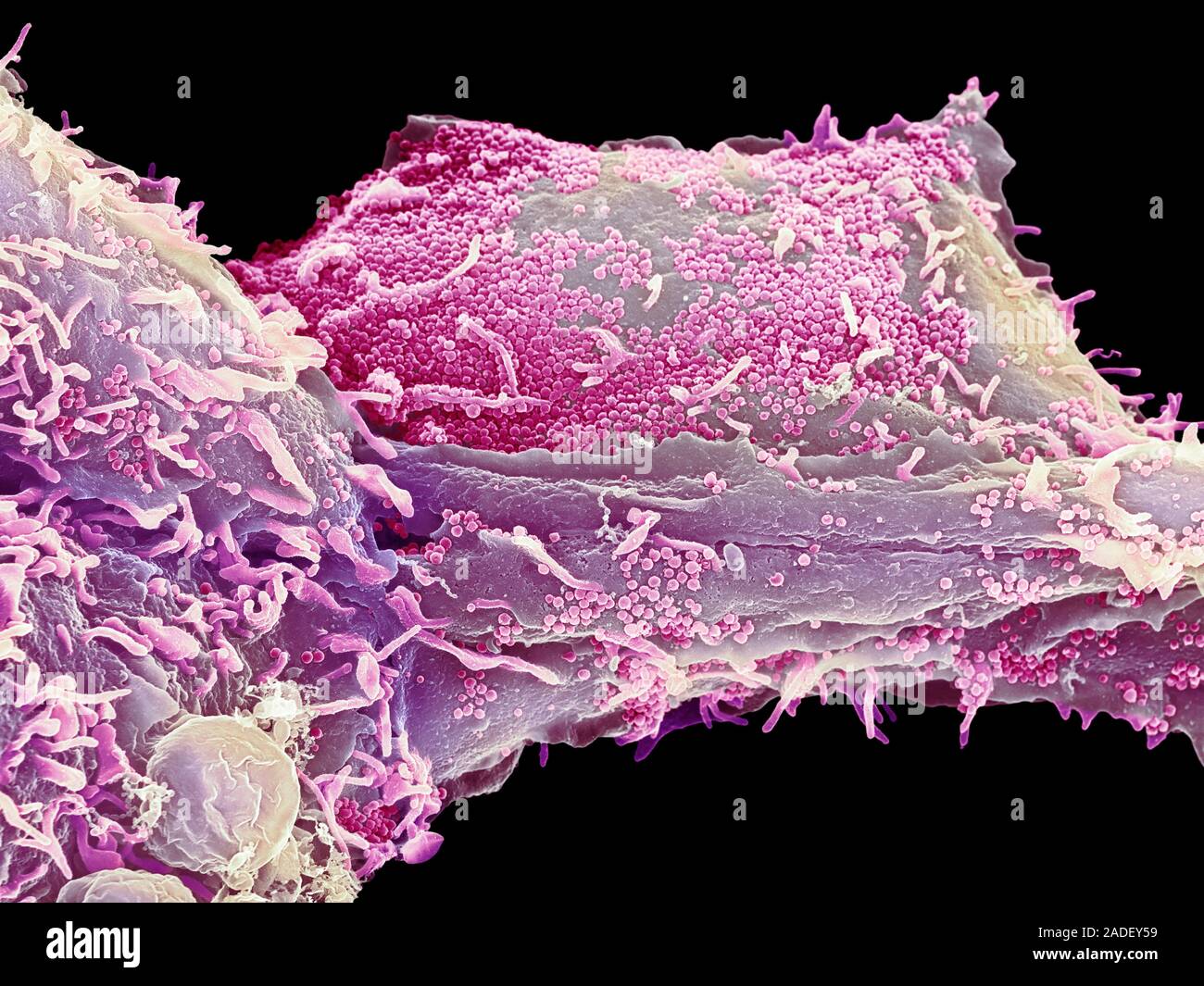 Cell infected with herpes virus. Coloured scanning electron micrograph ...