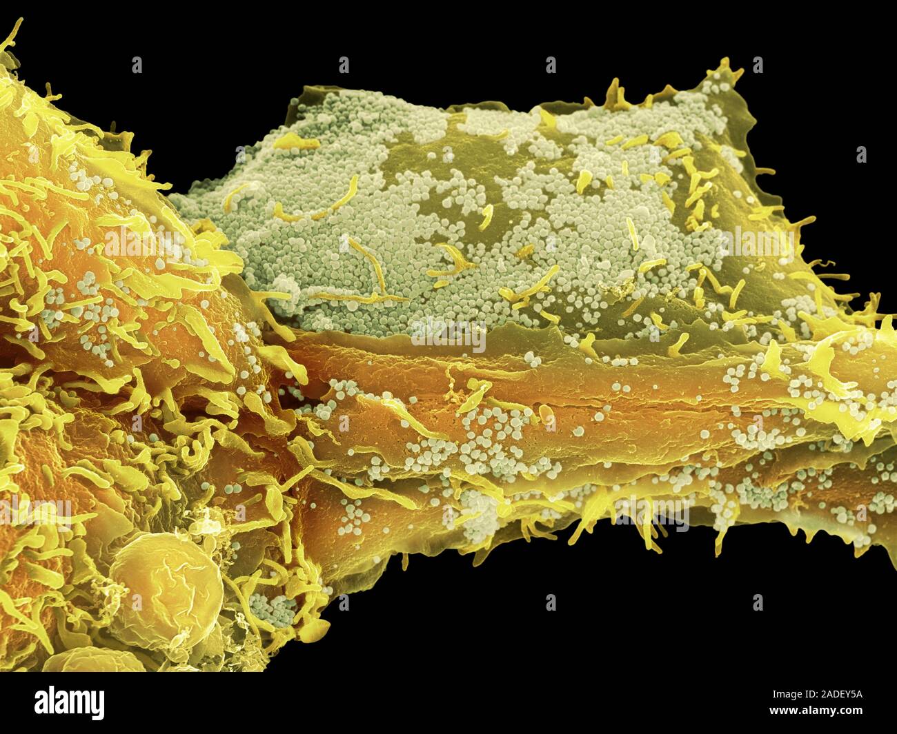 Cell infected with herpes virus. Coloured scanning electron micrograph ...