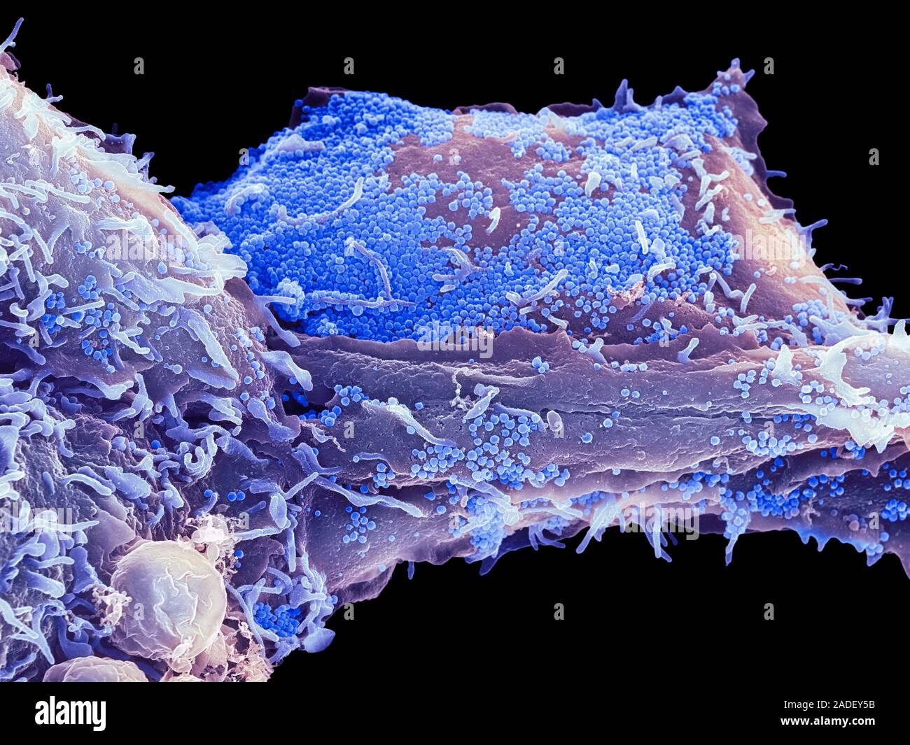 Cell infected with herpes virus. Coloured scanning electron micrograph ...